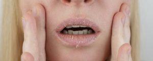 5 Side effects of Caffeine on your Skin - The Art of Living